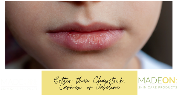 Natural ChapStick and Carmex Alternatives That Actually Heal Your Lips ...
